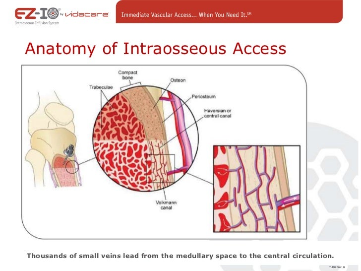 EZ I/O Presentation at FCA