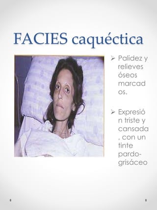 Facies Semiologías =) | PPTX