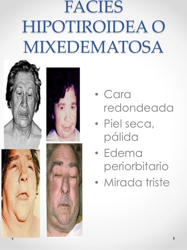 Facies Semiologías =)