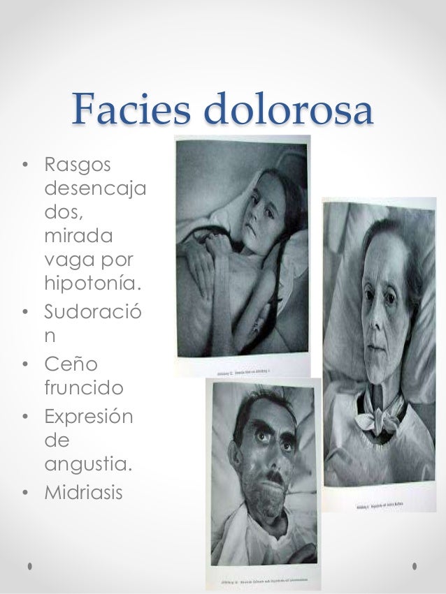 Facies Semiologías =)