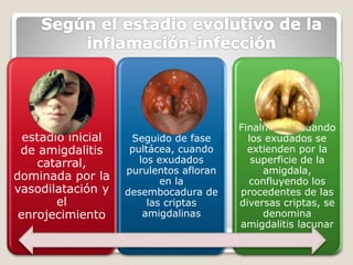 SEMIOLOGIA - Amigdalitis | PPTX