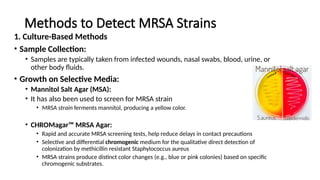 F. B lactamse and Extended Spectrum Beta Lactamasedetection .pptx