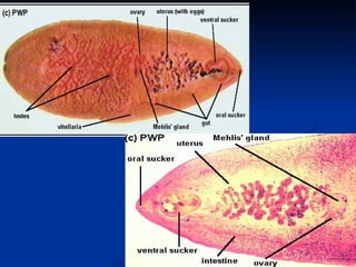 Fasciolopsis Buski Adult