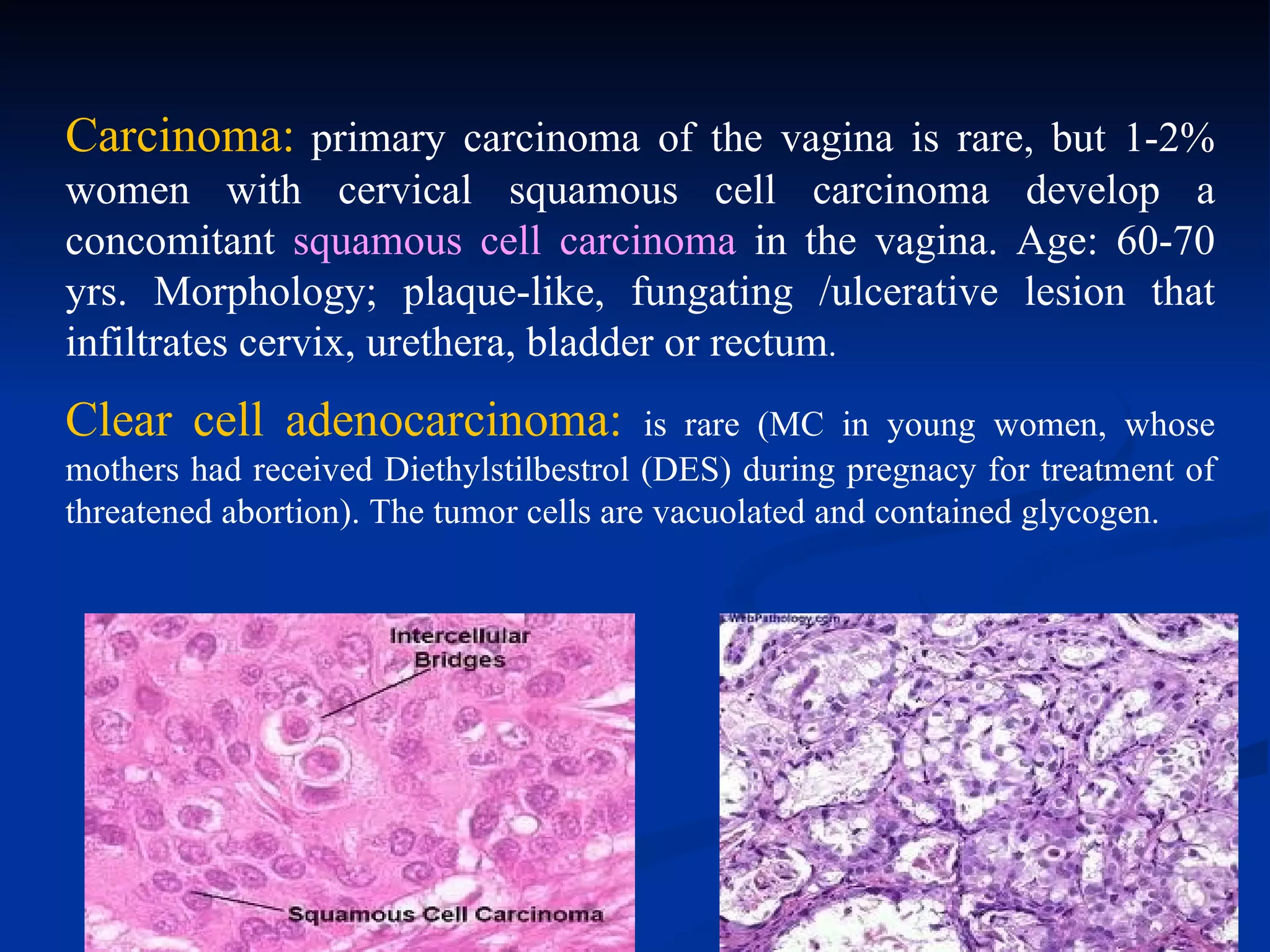 DISEASES OF THE FEMALE REPRODUCTIVE SYSTEM | PPT