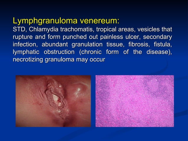 DISEASES OF THE FEMALE REPRODUCTIVE SYSTEM | PPT