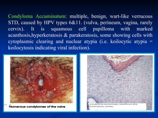 DISEASES OF THE FEMALE REPRODUCTIVE SYSTEM | PPT