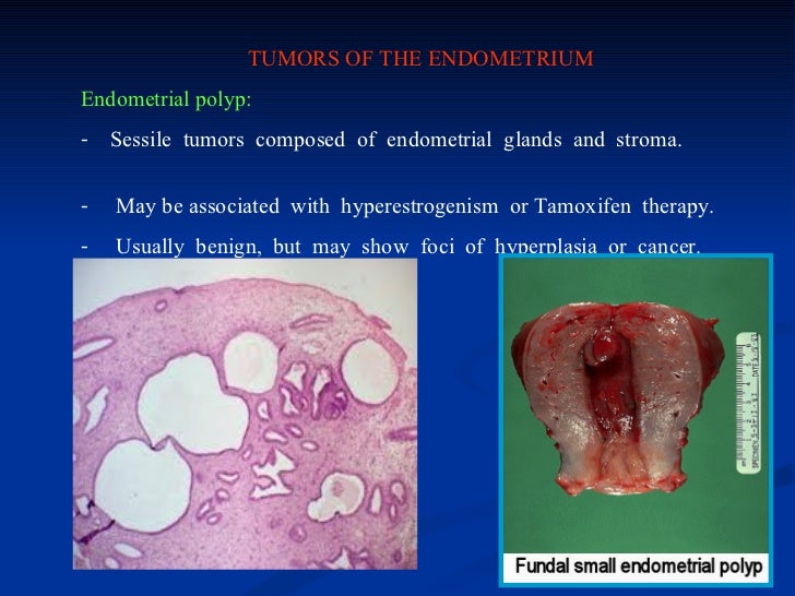 Diseases Of The Female Reproductive System