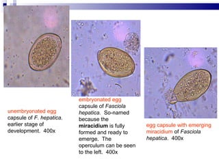 F.hepatica | PPT | Digestive Disorders | Diseases and Conditions