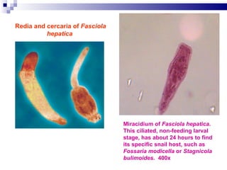 Fasciola Hepatica Slide