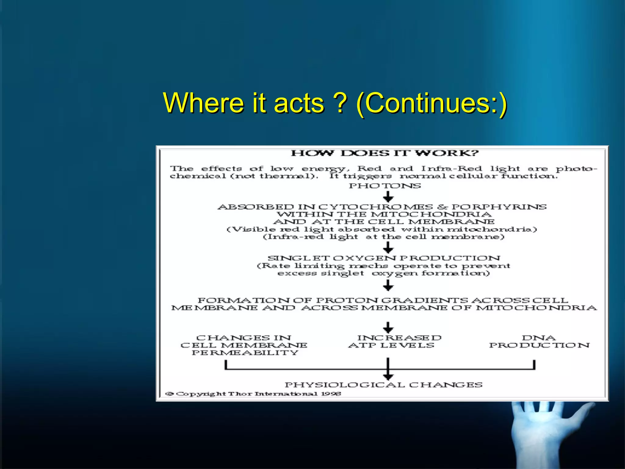 Medical Laser: Basic- | PPT