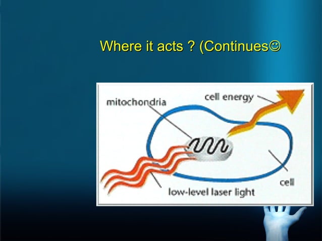 Medical Laser: Basic- | PPT