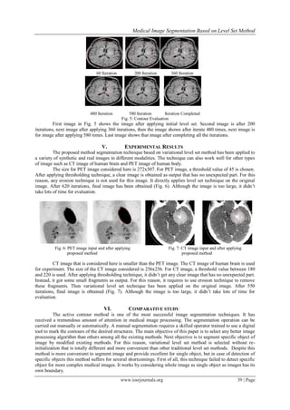 Medical Image Segmentation Based on Level Set Method | PDF