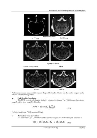 Multimodal Medical Image Fusion Based On SVD | PDF