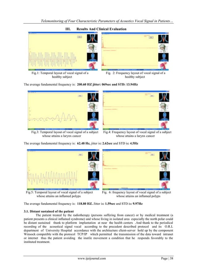 Telemonitoring of Four Characteristic Parameters of Acoustic Vocal ...
