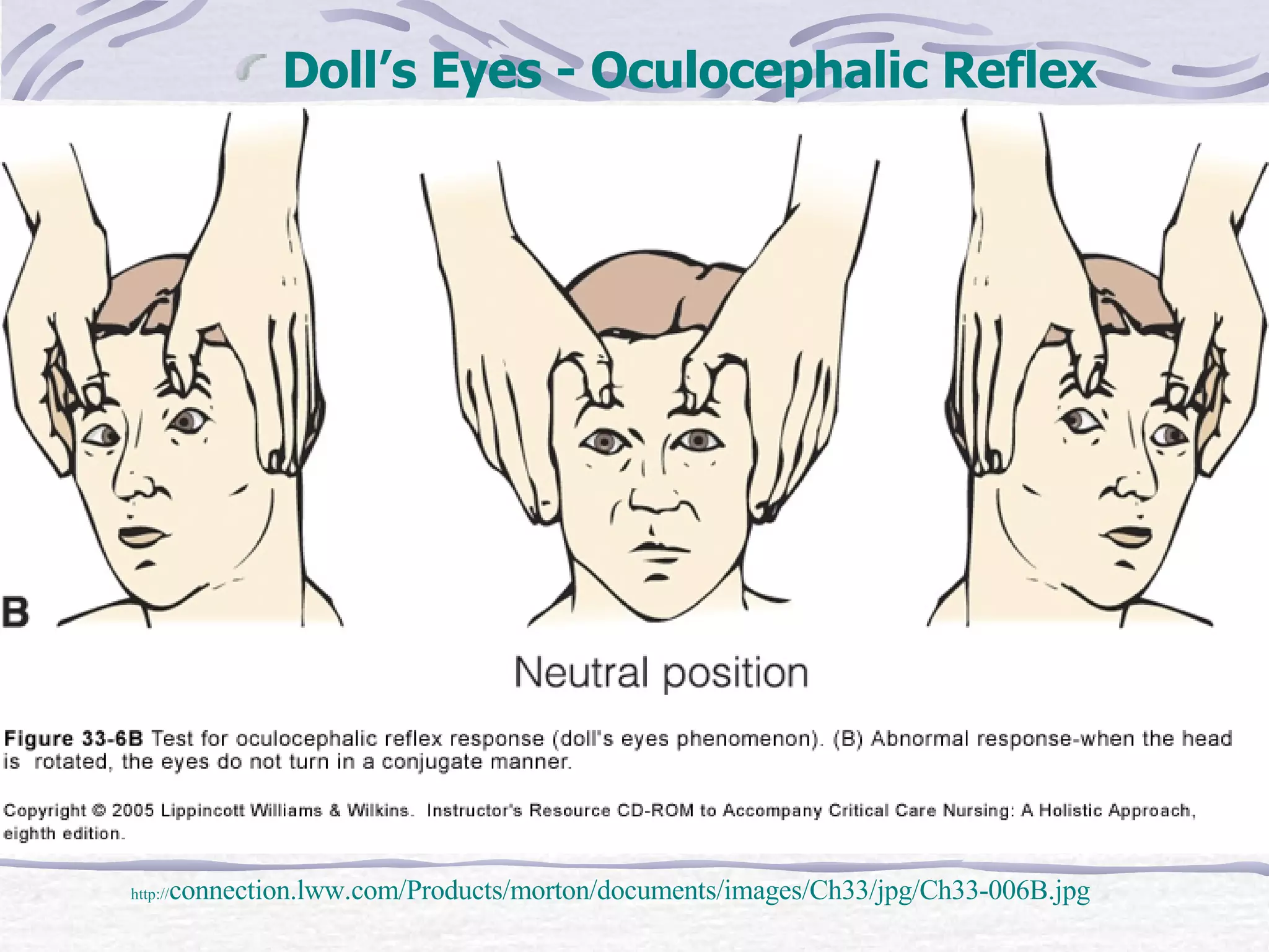 NurseReview.Org - Nursing Management of the Adult Client with ...