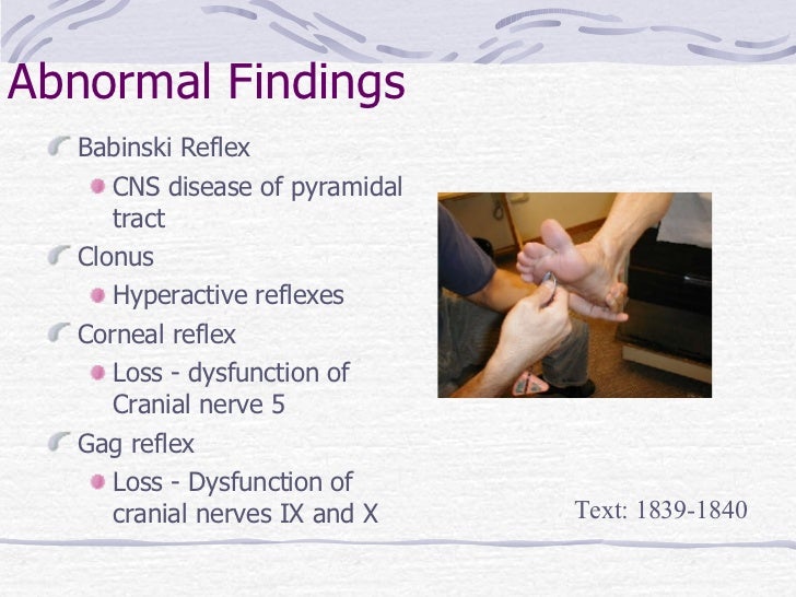 Causes Of Abnormal Babinski Reflex In Adults - boardsbertyl