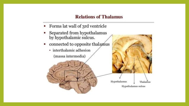 Thalamus and hypothalamus | PPT