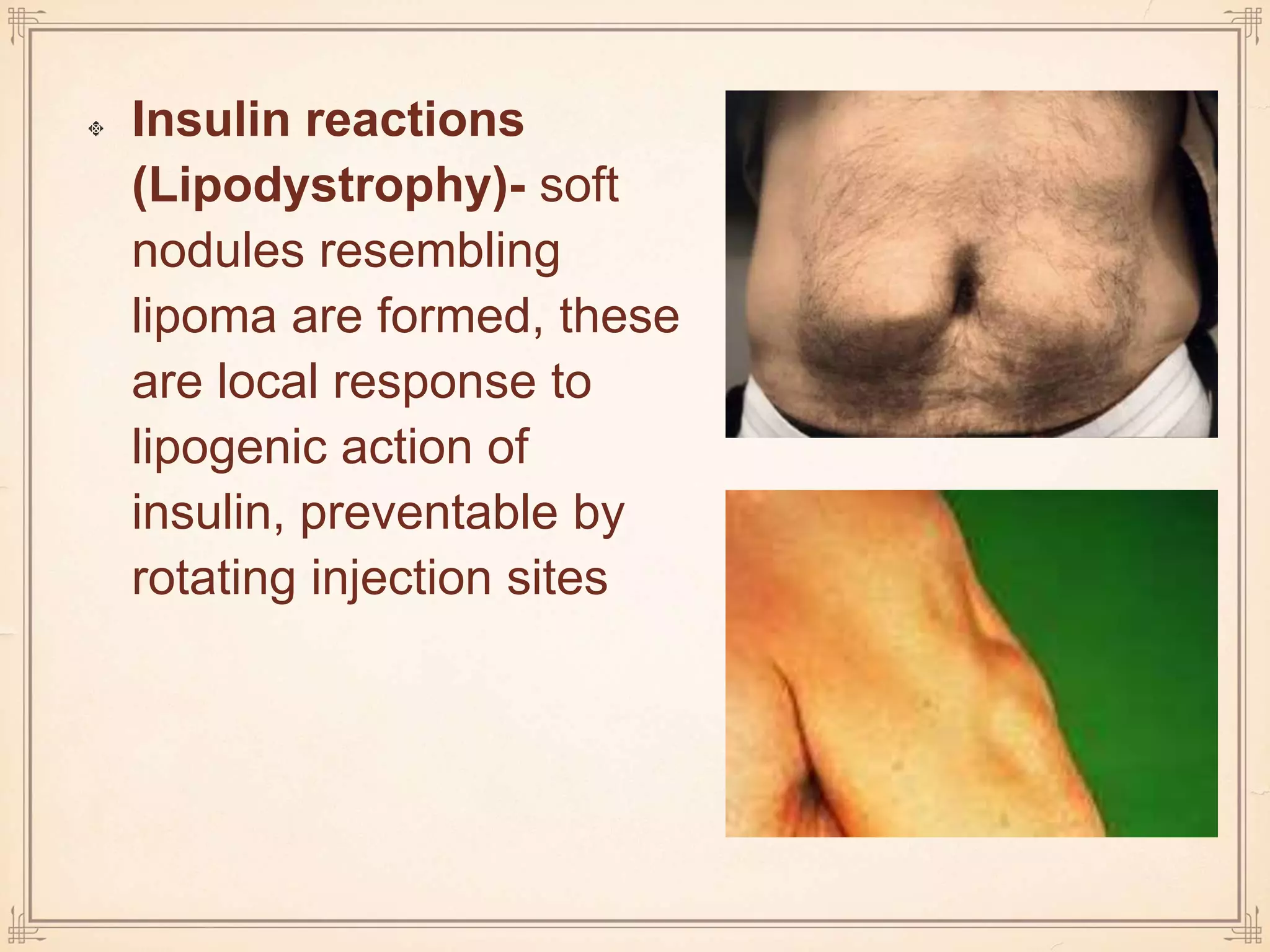 Dermatological manifestation of systemic diseases | PPTX