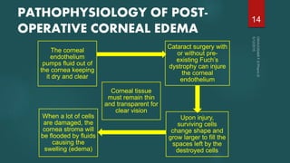 POST-OPERATIVE-CORNEAL-EDEMA | PPTX