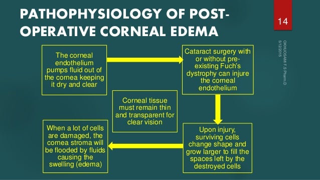 Postoperative Corneal Edema Background Pathophysiology