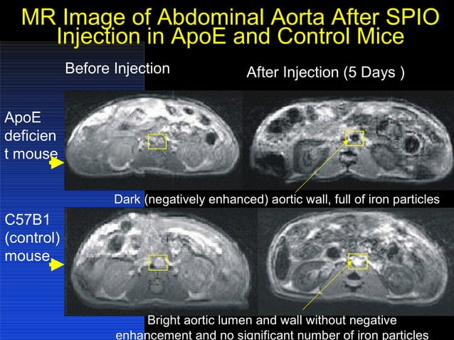 Spio mri studies by dr naghavi-presented to ge-amersham | PPT