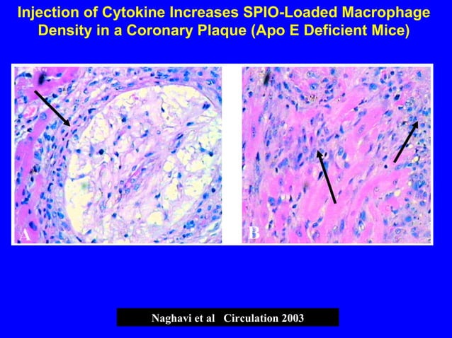 Spio mri studies by dr naghavi-presented to ge-amersham | PPT