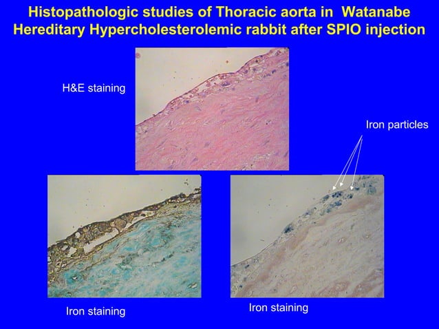Spio mri studies by dr naghavi-presented to ge-amersham | PPT