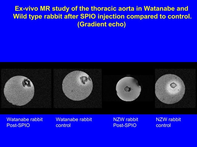 Spio mri studies by dr naghavi-presented to ge-amersham | PPT