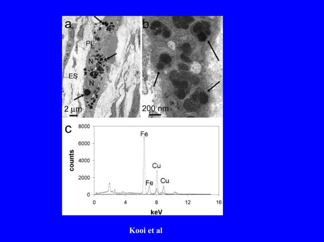 Spio mri studies by dr naghavi-presented to ge-amersham | PPT