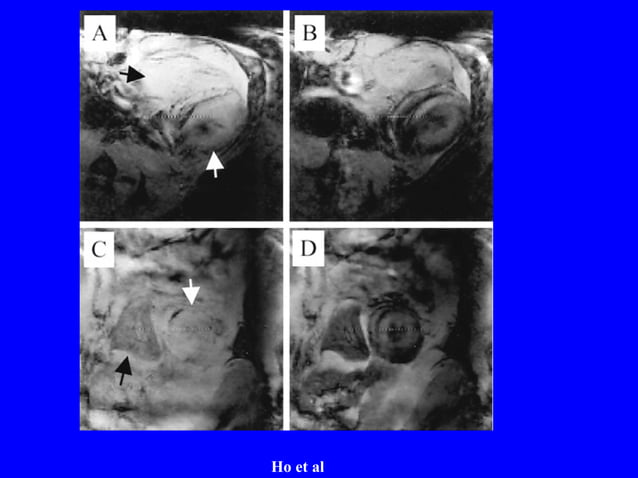Spio mri studies by dr naghavi-presented to ge-amersham | PPT