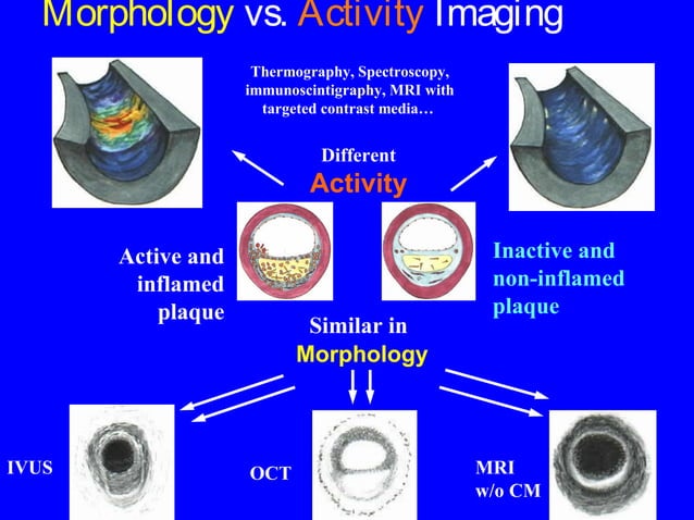 Spio mri studies by dr naghavi-presented to ge-amersham | PPT