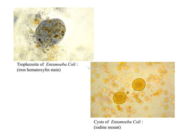 Intestinal protozoa ( Entamoeba, Giardia, Dientamoeba | PPTX