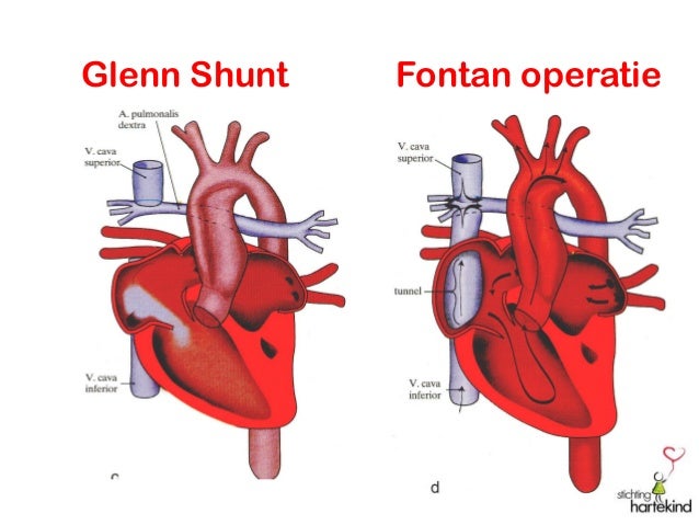 Presentatie Hartekind 2015