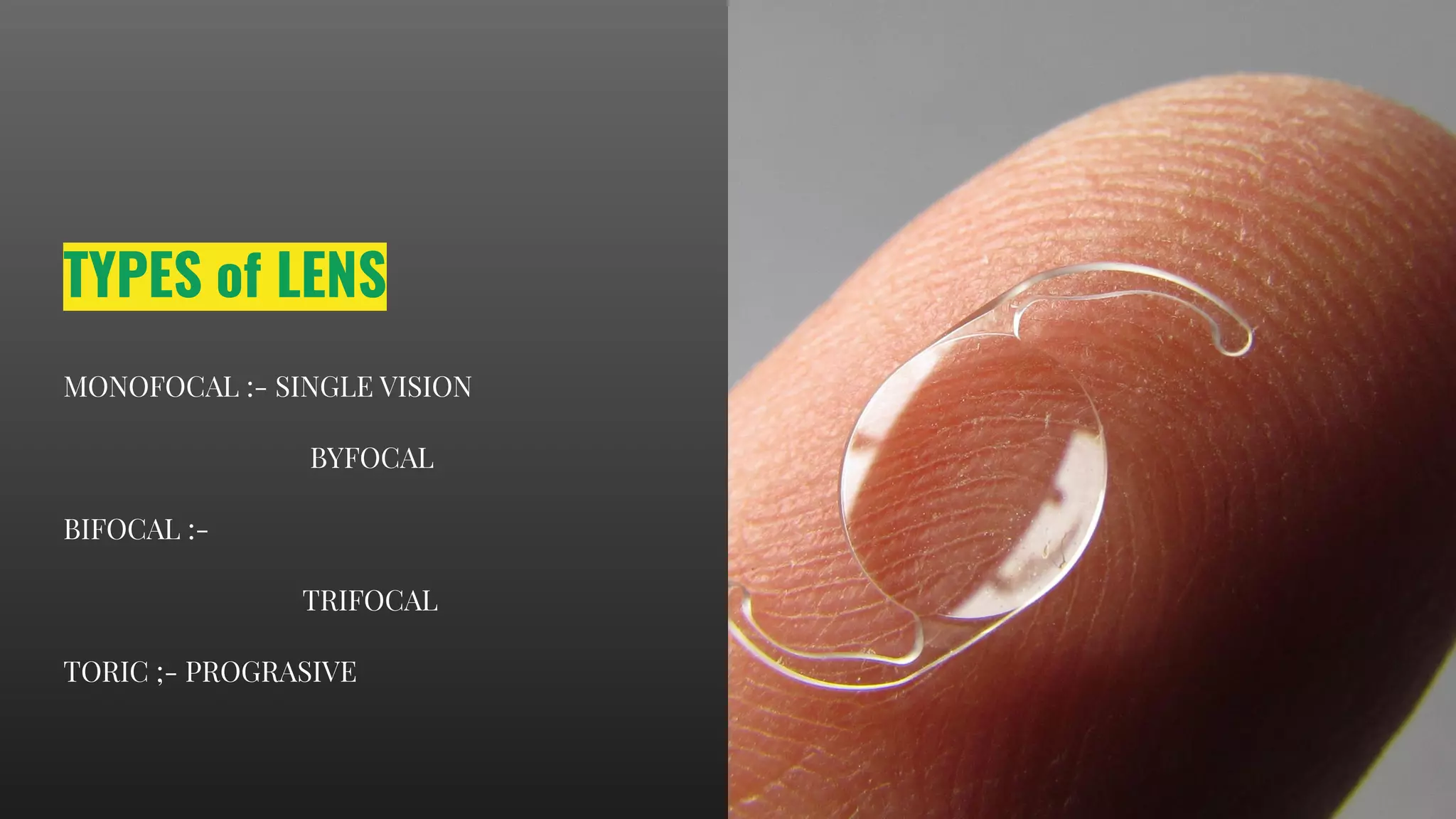 Cataract presentation | PDF