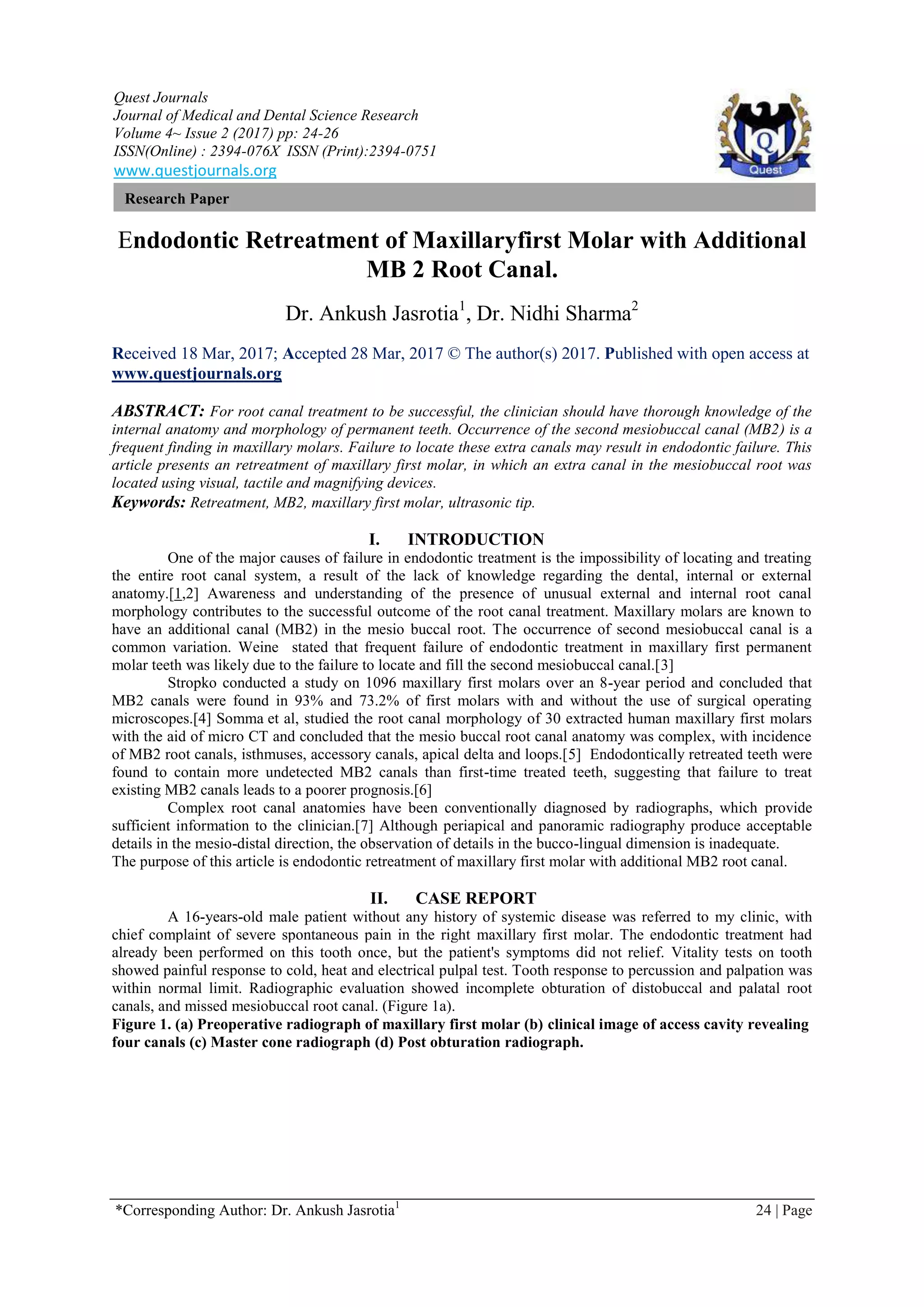 Endodontic Retreatment of Maxillaryfirst Molar with Additional MB 2 ...