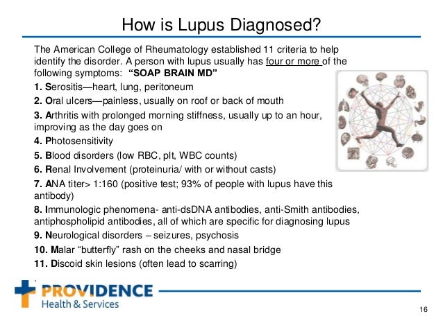 Ana Milan Pericarditis And Lupus