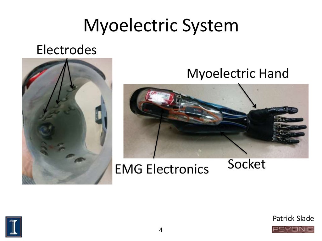 Senior Design - Myoelectric Prosthetic Hand