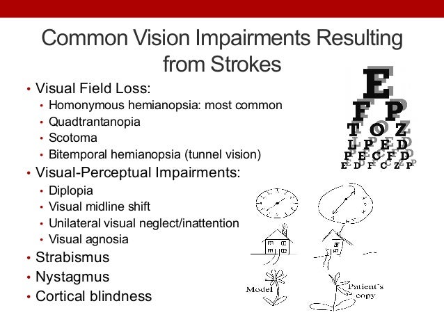 Vision Deficits Post-Stroke In-Service