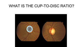 f7._ophthalmoscopy_judith_warner_md.pdf