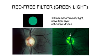 f7._ophthalmoscopy_judith_warner_md.pdf