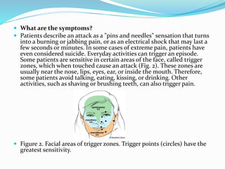 Triageminal Neurolagea | PPTX