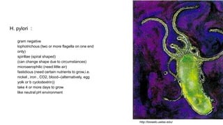 H.pylori and IHC 2 | PPTX