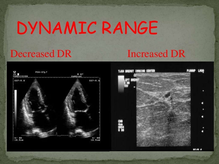 Basics of ultrasound machine