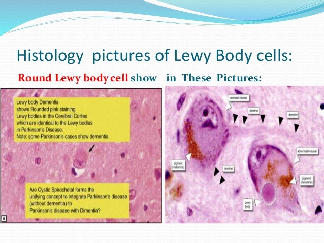 Dementia Power. Point