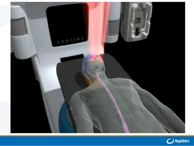 RapidArc PowerPoint Presentation