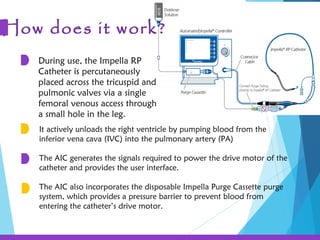 Device Impella RP-Sales Project | PPT