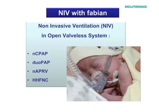 Fabian therapy evolution setup | PDF