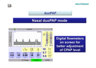 Fabian therapy evolution setup | PDF