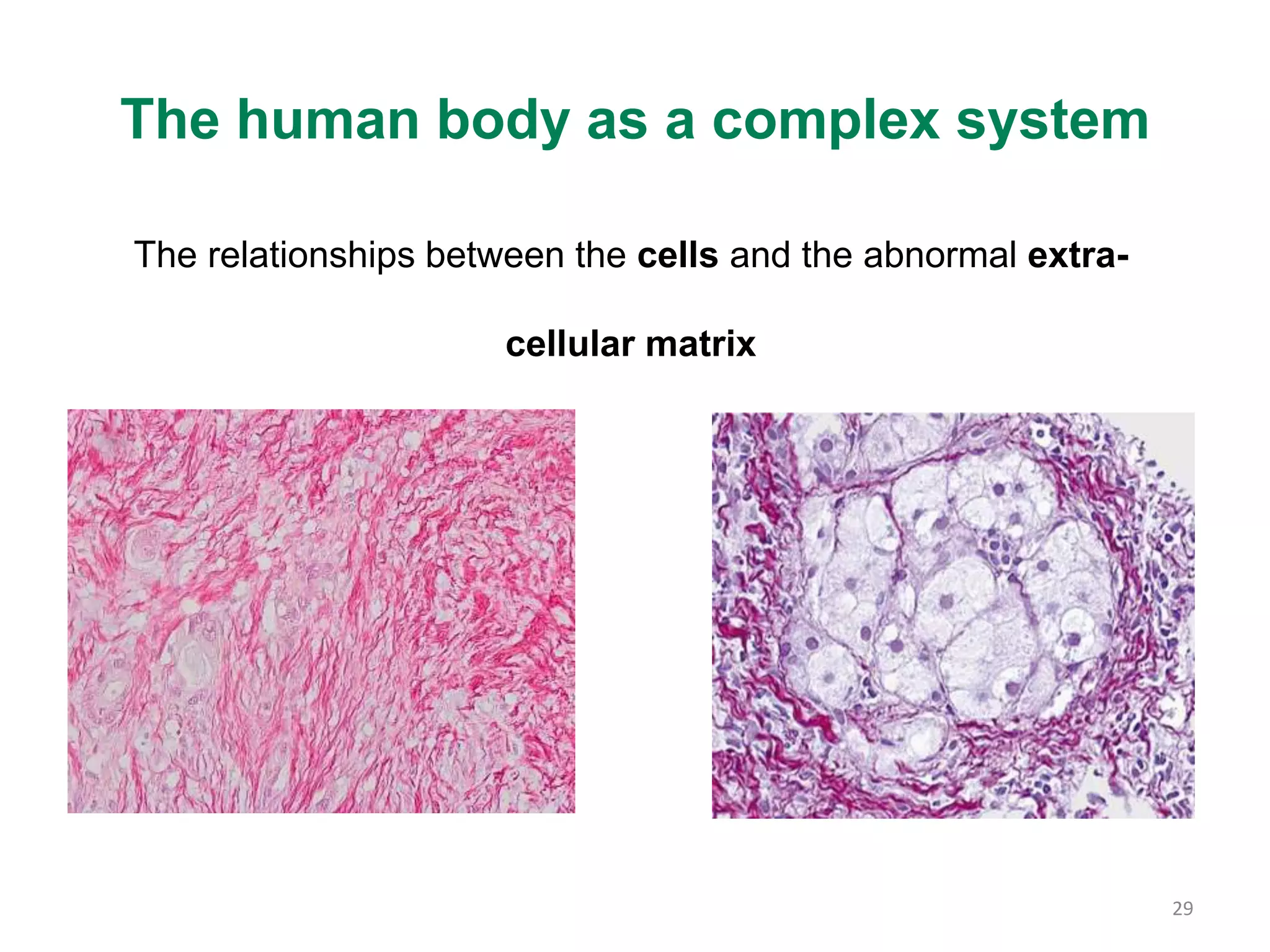 Spectral analysis for tumour diagnosis and classification in surgical ...