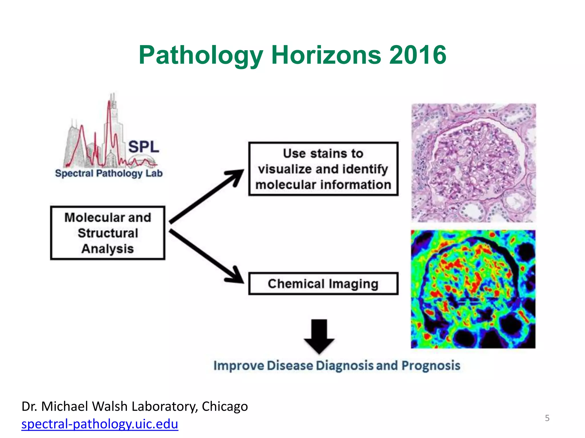 Spectral analysis for tumour diagnosis and classification in surgical ...